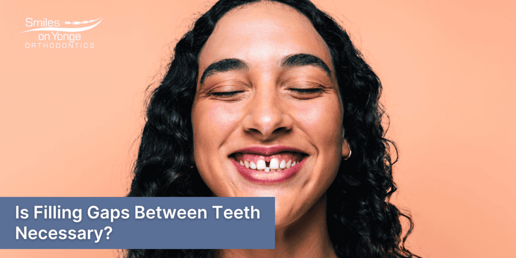 Can A Dentist Fill Gaps Between Teeth? A Dental Filling Guide